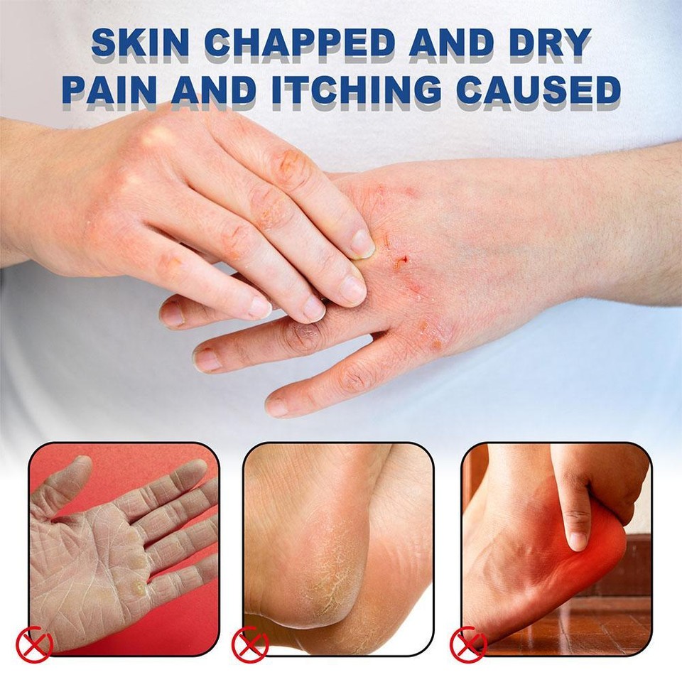 Hand and Foot Care Stick 40g Smooth Moisturizing Stick Prevent Skin ...