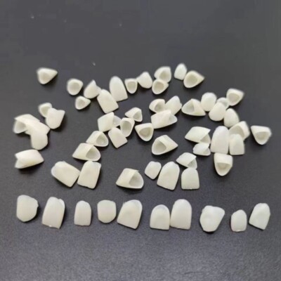 130pcs/2packs Dentist Dental Temporary Crown Material For Anterior ...