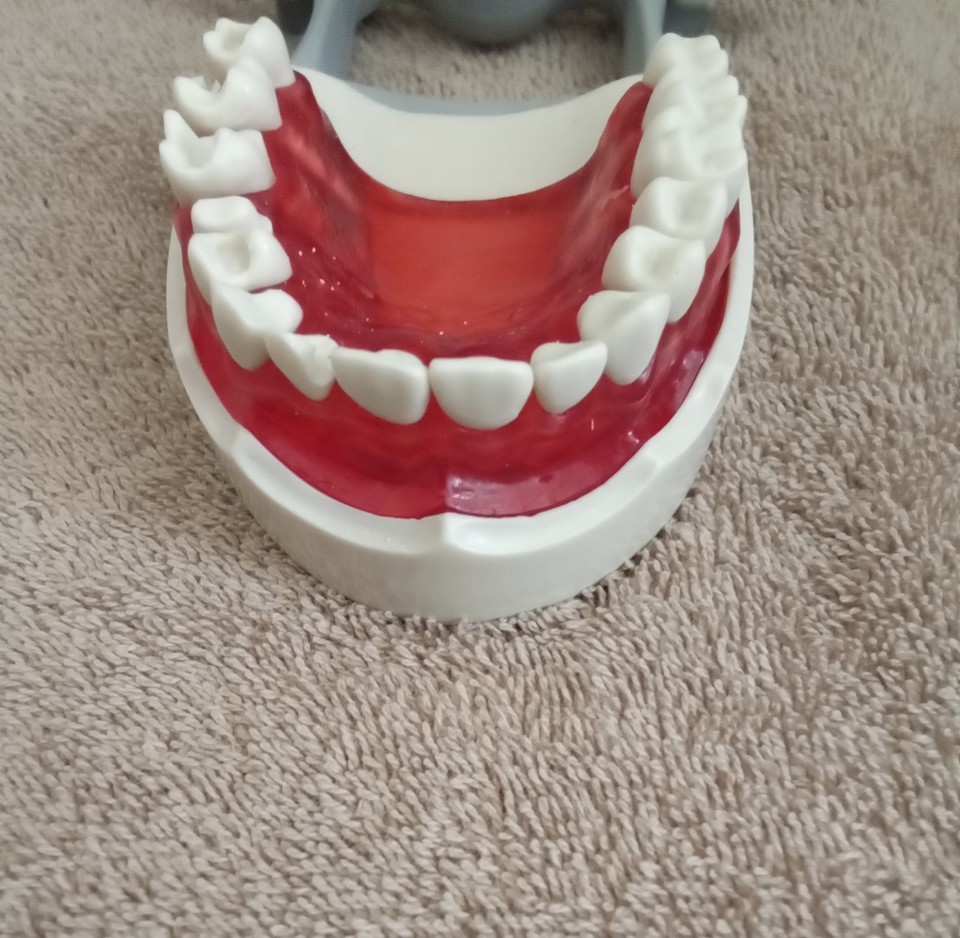 COLUMBIA DENTOFORM DENISTRY TYPODONT MISSING / BROKEN / DECAY HOLES ...