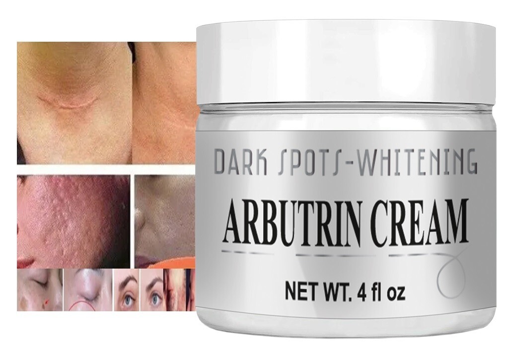 GEL cream darkspot Acne 4 Face fade support removes Dark Spots Neck ...
