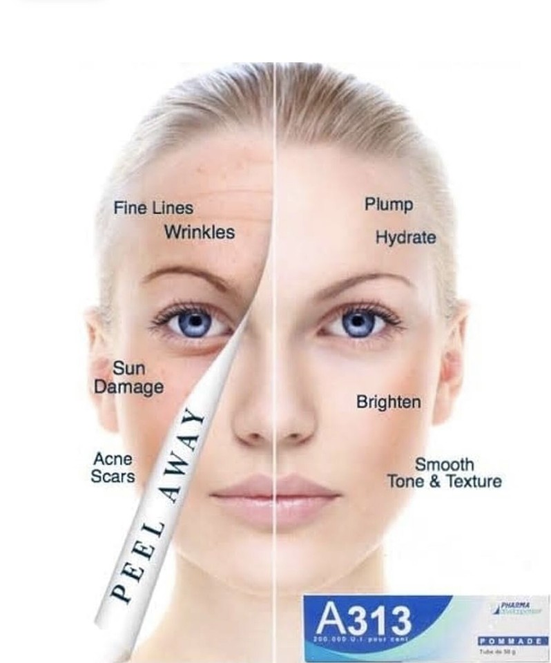 French A313 Retinol Cream for Anti-Aging, Reduce Wrinkles and ...