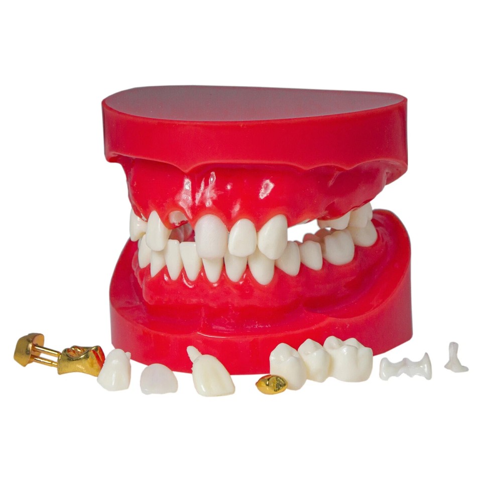 Dental Overdenture Practice Demo Implant Series Typodont Teeth ...