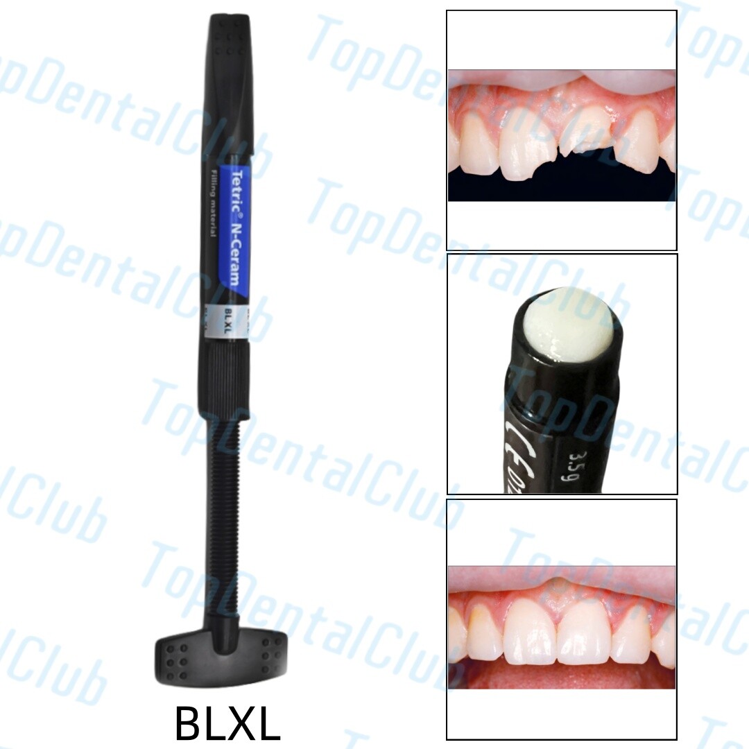 BLXL Dental Tetric N-Ceram Composite Resin BL XL Bleach Color Whitening ...