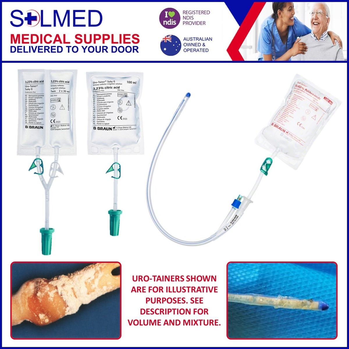 Catheter Irrigation Procedure