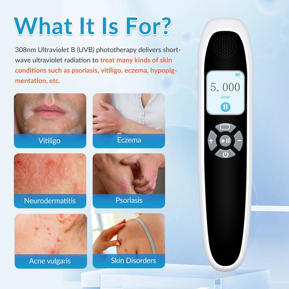 308nm Excimer Blue Uvb Light Therapy Phototherapy for Skin Diseases ...