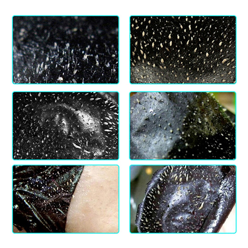 10pc Nose Blackhead Remover Mask Shrink Pore Mask Deep Nose Pore ...