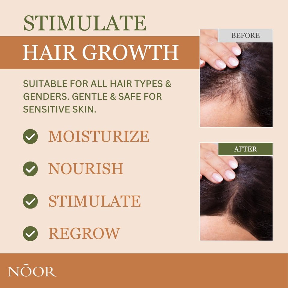 Wonder Growth Spray for Women, 9-in-1 SuperBoost, Natural Hair Loss ...