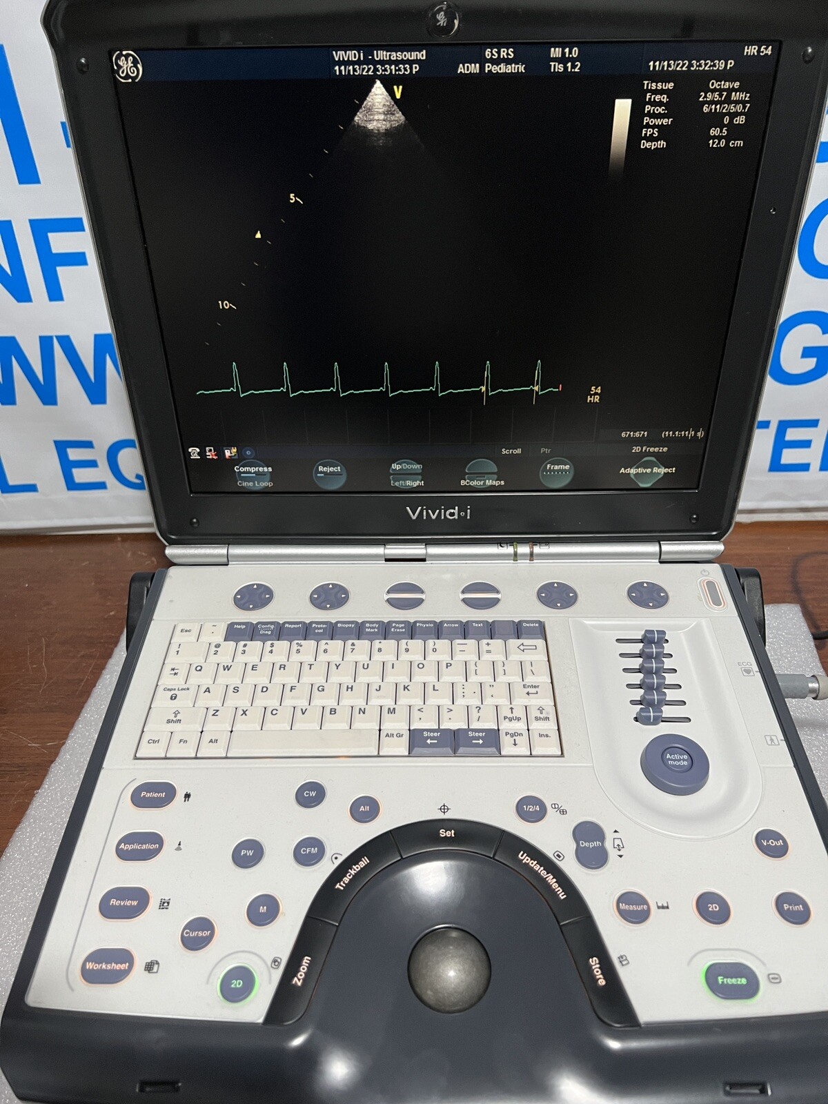 GE VIVID i Ultrasound with 6S-RS Cardiac Pediatric probes (READ THE ...