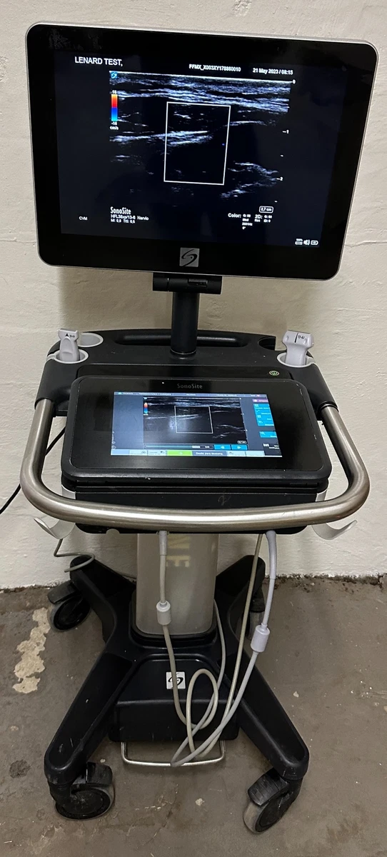 Ultrasound Machine Sonosite