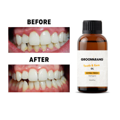 SUPER POTENT GUM DISEASE BAD BREATH CURE BLEEDING RECEDING EXTRA GUMS ...