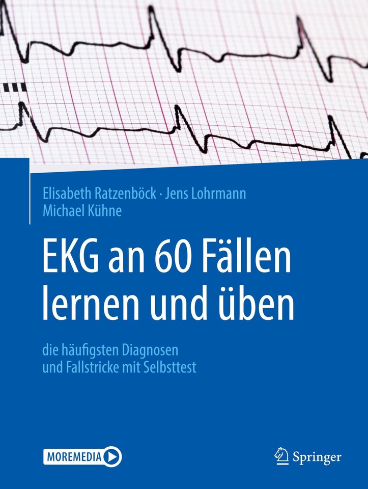 EKG an 60 Fällen lernen und üben | die häufigsten Diagnosen und ...