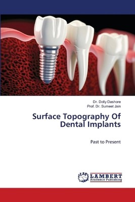 Surface Topography Of Dental Implants by Dr Dolly Dashore Paperback ...