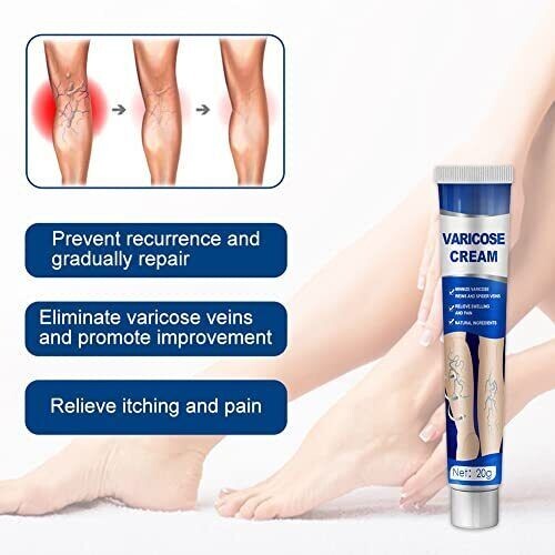 Varicose Cream Varicose Leg Cream for The Legs Massage 20GR/*/*/ | eBay