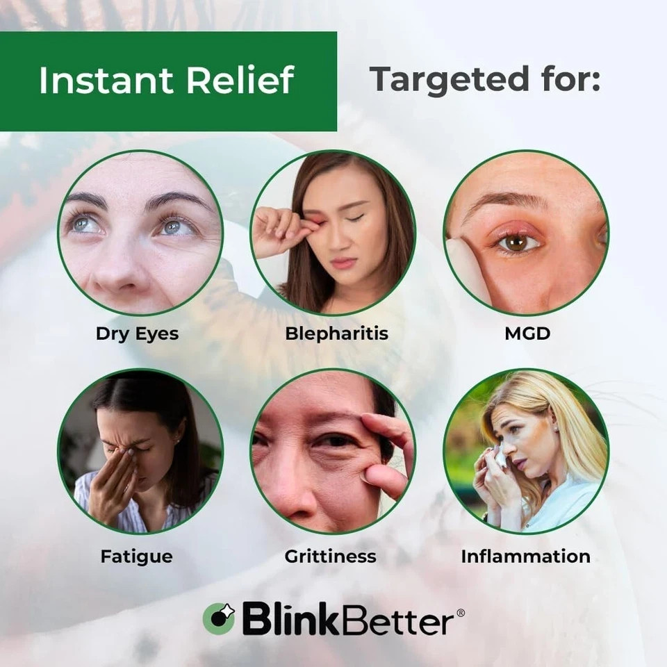 BlinkBetter Tea Tree Oil Eyelid Wipes - 60 x Natural Blepharitis MGD ...