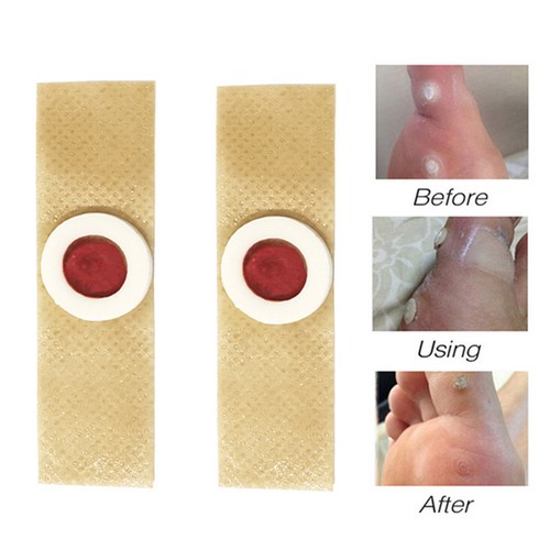 AU 24pcs Foot Corn Detox Sticker Toe Calluses Thorn Patches with Corns ...