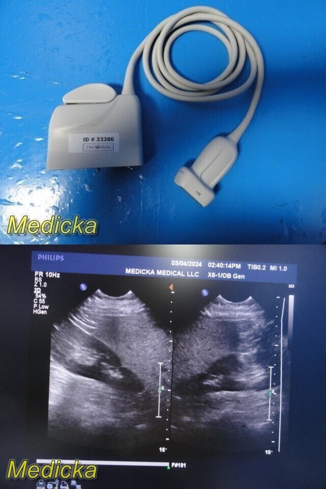 Philips X6-1 Matrix Array Ultrasound Probe (Ref 453561247501) *TESTED ...