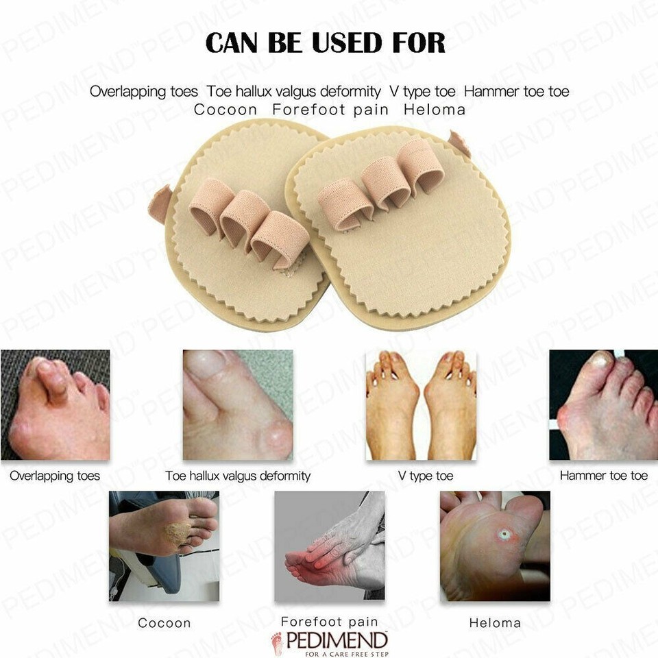 PEDIMEND™ Toe Overlap Preventer, Corrector Fore Foot Blisters Corn Care ...