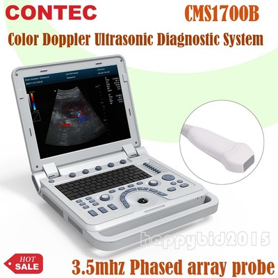Imaging & Aesthetics Equipment - Transrectal Probe