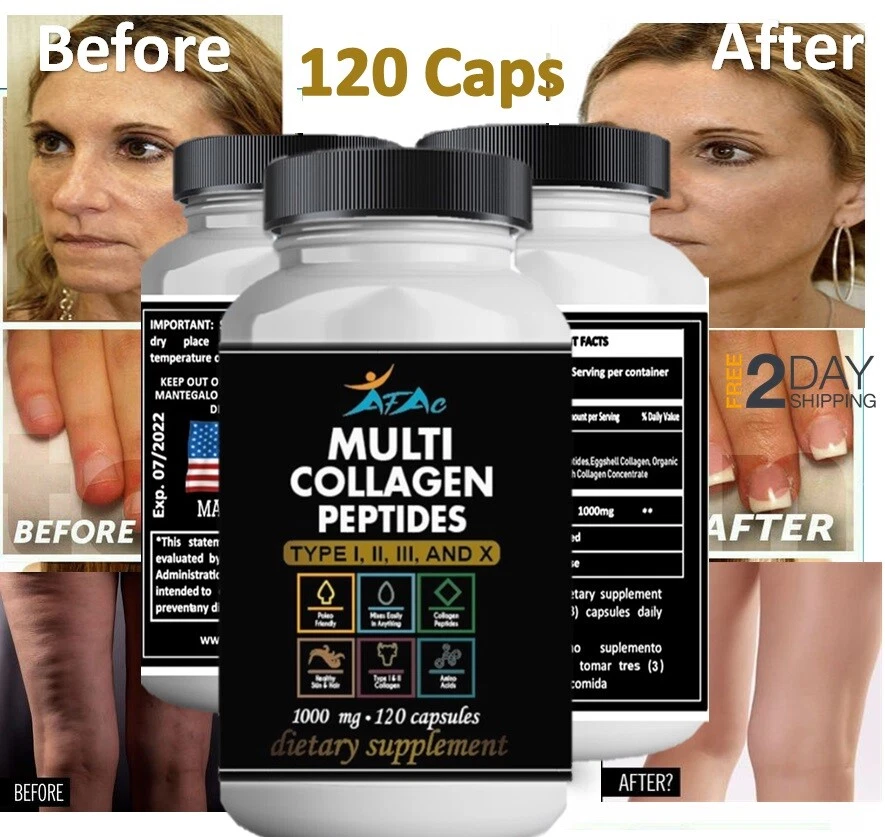 Colágeno Hidrolizado Tipo 1 2 Y 3 Online | emergencydentistry.com