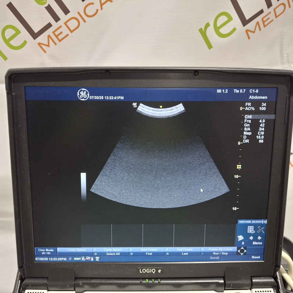 GE Healthcare NextGen Logiq e Ultrasound | eBay