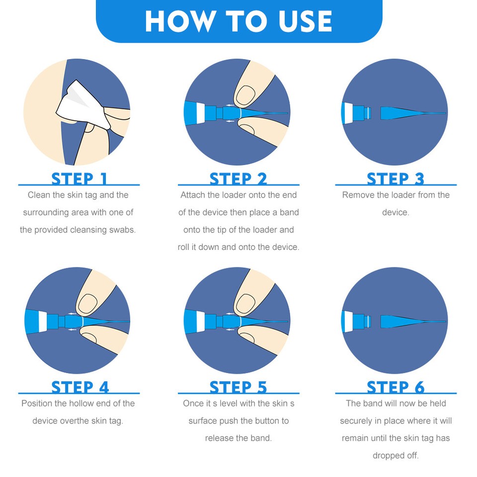 2 in 1 Natural Painless Auto Skin Tag Removal kit Skin tag bands ...