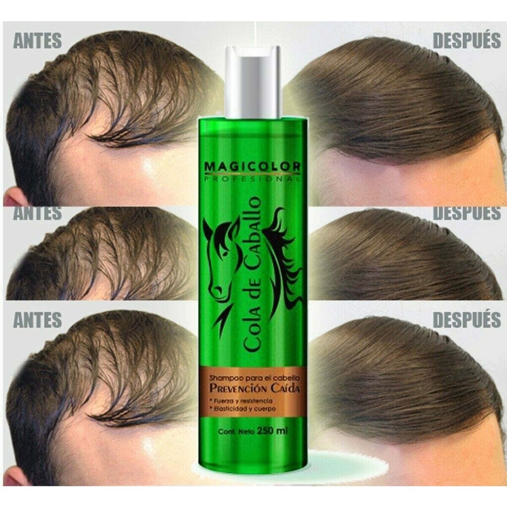 Magicolor Platinador Matizador Hair Growth Red Purple Black Shampoo ...