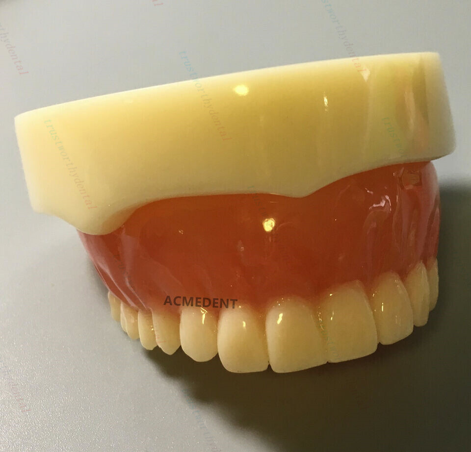 Dental Full Denture Model Overdenture Magnetic Attachment Mandibular ...