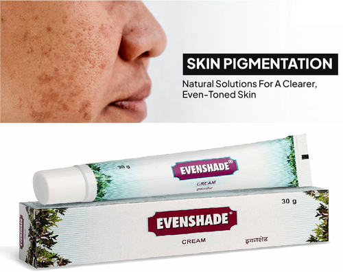 Ayurvedic Melasma Treatment Cream skin pigmentation like melasma ...