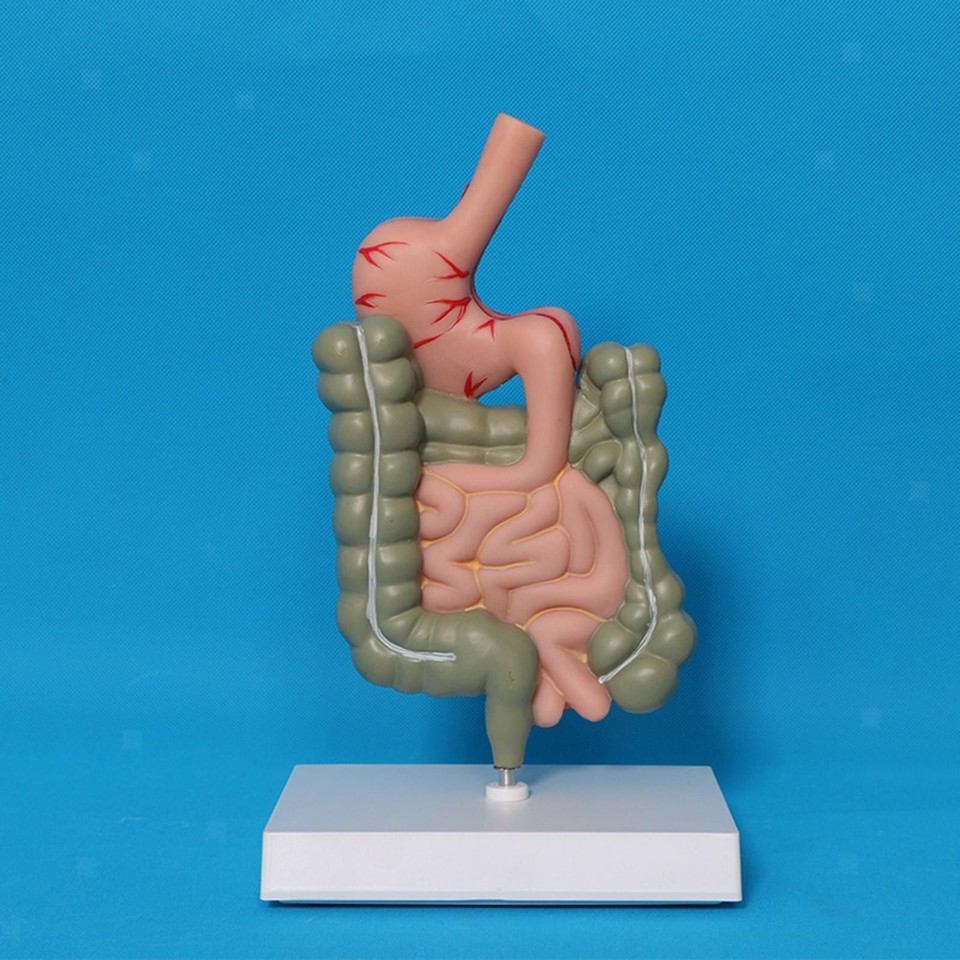 Human Digestive System Model Large Intestine Cecum Model Professional ...