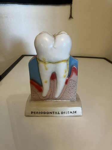 Vintage Giant tooth teeth brushing dental education Periodontal Display ...