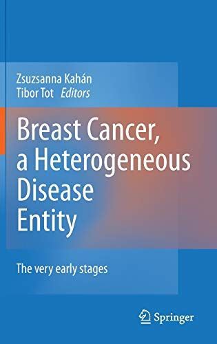 Breast Cancer, a Heterogeneous Disease Entity: The Very Early | eBay