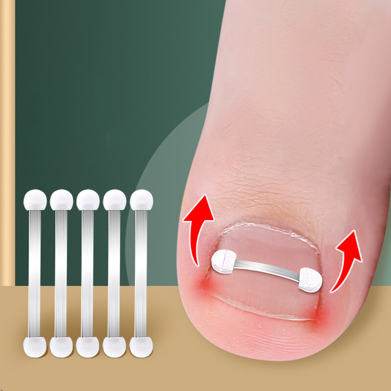 Professional Ingrown Toenail Corrector Tool Ingrowing Toe Nail Feet ...