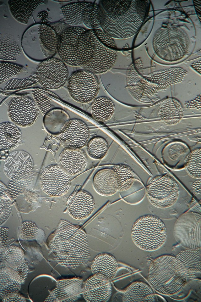 Antique microscope slide by Eduard Thum. Diatoms from Cementstone ...