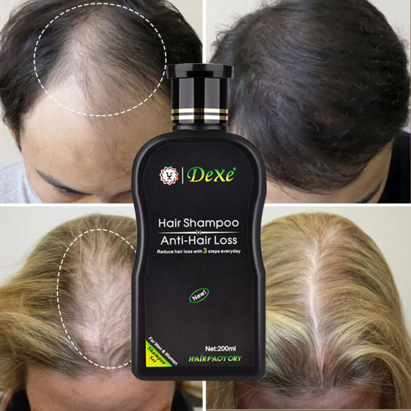 Hair Growth Shampoo Hair Regrowth Treatment Anti-Hair Loss Shampoo For ...
