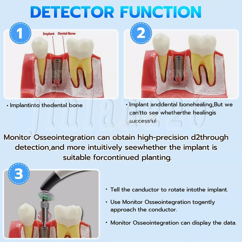2025 Dental ISQ Implant Stability Device Dental Implant Monitor ...