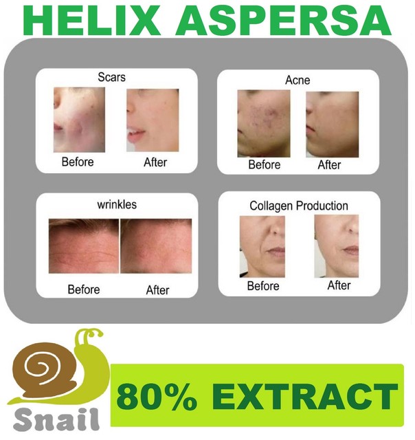 X3 Unid Karakol Kream Baba Crema De Caracol Manchas ESTRIAS Snail Cream ...