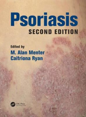 Psoriasis, Hardcover by Menter, M. Alan, M.D. (EDT); Ryan, Caitriona, M ...