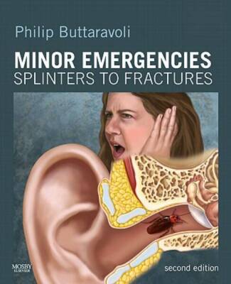 Minor Emergencies, 2e - Paperback By Buttaravoli MD FACEP, Philip ...