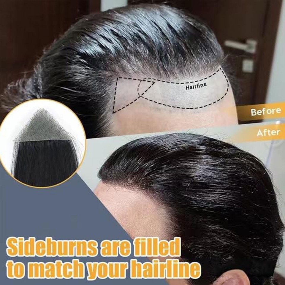 Front Hairline 100% Human Hair Patch Full Skin Base Cover-Up Topper ...