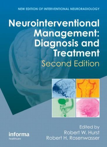 Neurointerventional Management : Diagnosis and Treatment, Second ...