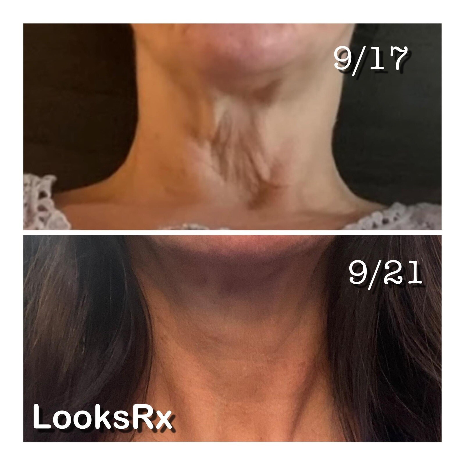 SkinMedica Neck Correct Cream Full Size 2oz/ 56.7g NEW IN BOX SEALED | eBay