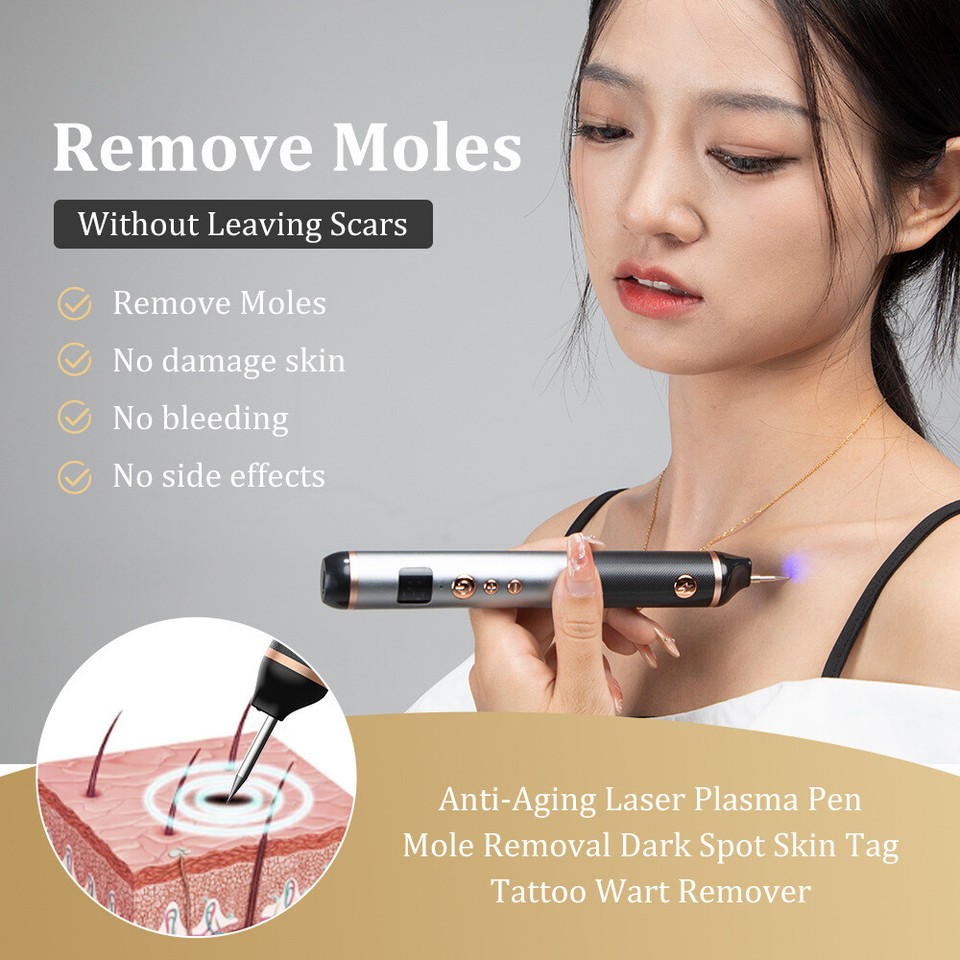 Black Spot Wart Removal Plasma Pen Skin Label Remover Laser Tattoo Mole ...