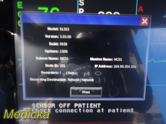 Spacelabs 91393 Xprezzon Monitor W/ PSU, Command & Print Modules, Leads ...