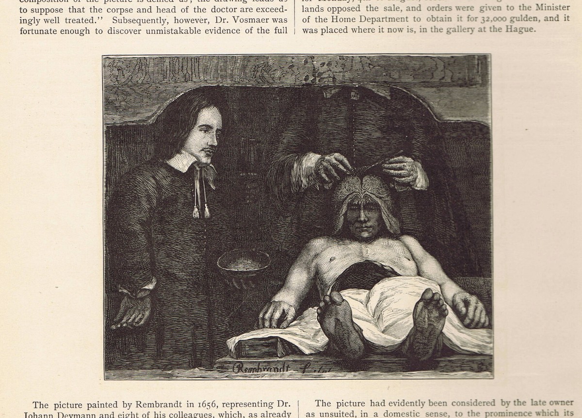 Rembrandt Anatomy Lesson Of Dr Deyman