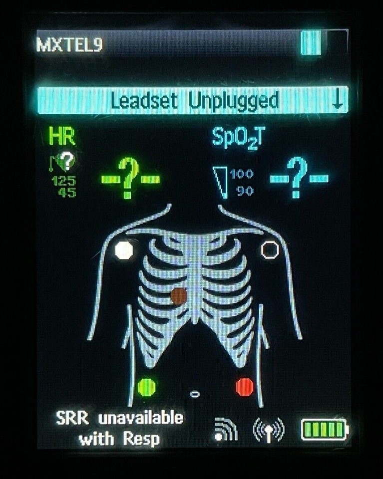 Philips IntelliVue MX40-1B4 Patient Monitor 1.4GHz S02; ECG + SpO2 w ...