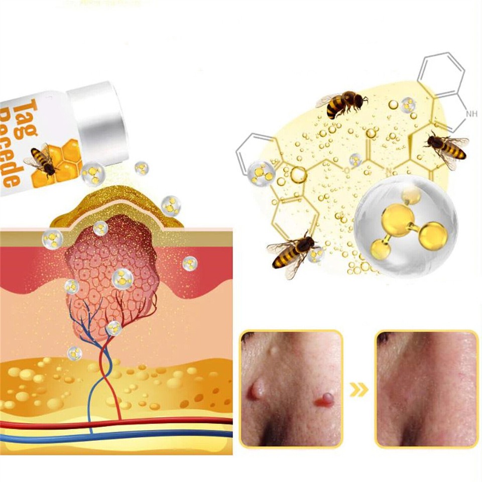 NEW Tag Recede Bee Venom Treatment Spray Tag Recede Bee Venom Spray for ...