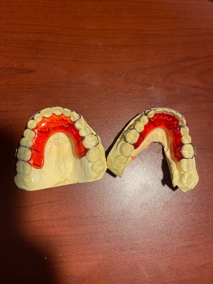 CUSTOM HAWLEY RETAINERS/Orthodontic Dental Braces ( FREE shipping & Imp ...
