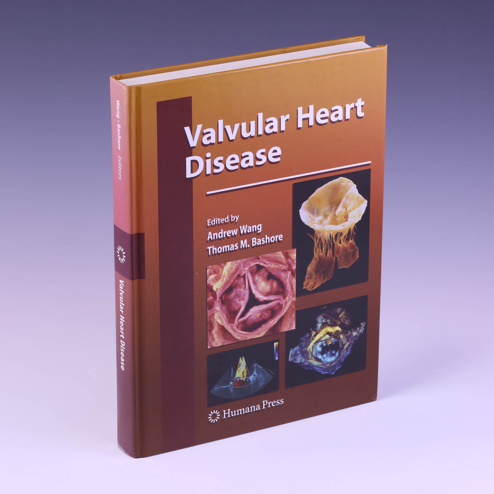 Valvular Heart Disease (Contemporary by Andrew Wang & Thomas M. Bashore ...