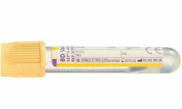 BD Medical 367986 Vacutainer Plus Plastic SST Blood Collection Tube ...