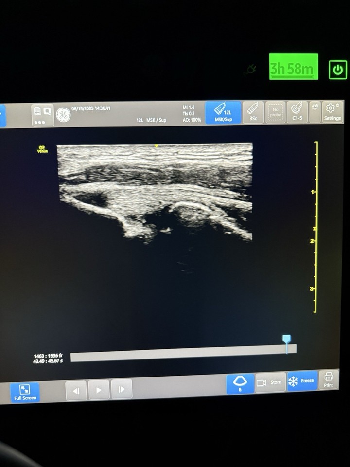 GE Venue R2 Ultrasound System LCD Flat Touchscreen Monitor Choice Of ...